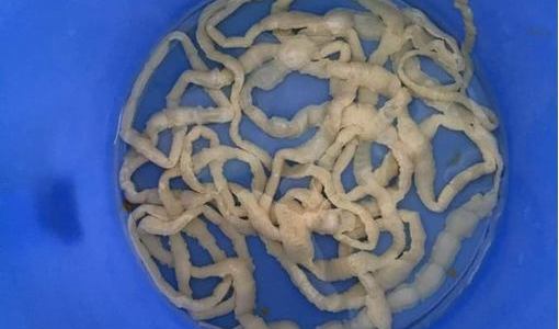 Xổ thành công sán sơ mít dài 8m trong bụng 2 mẹ con