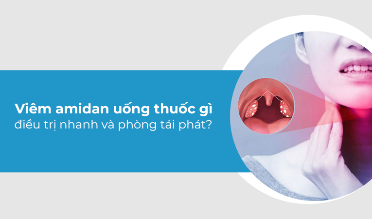 Viêm amidan uống thuốc gì điều trị nhanh và phòng tái phát?